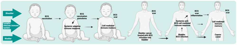 Inflammation in the scar caused by BCG... | Wellcome Open Research