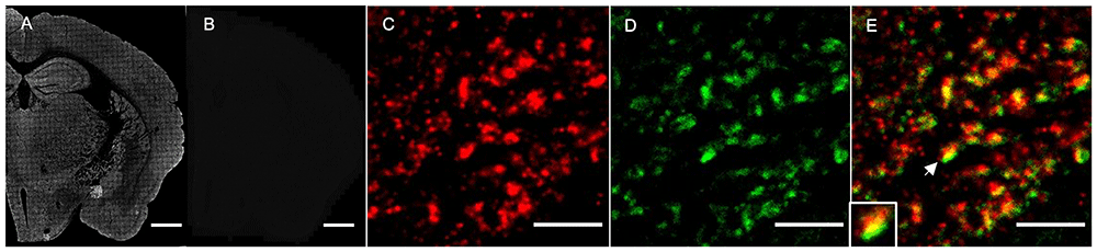 SV2A is expressed in synapse... | Wellcome Open Research