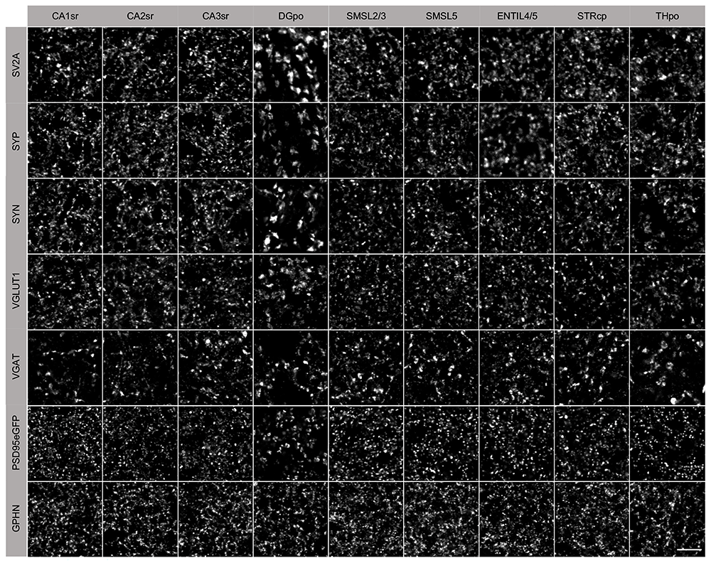 SV2A is expressed in synapse... | Wellcome Open Research