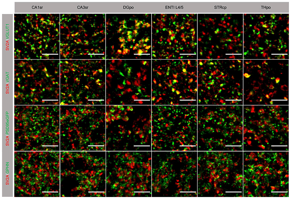 SV2A is expressed in synapse... | Wellcome Open Research