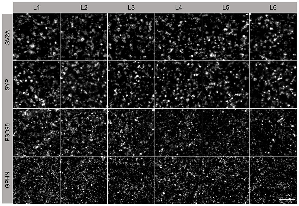 SV2A is expressed in synapse... | Wellcome Open Research