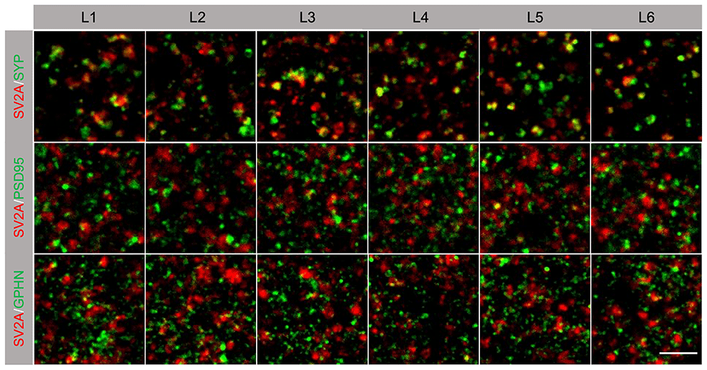 SV2A is expressed in synapse... | Wellcome Open Research